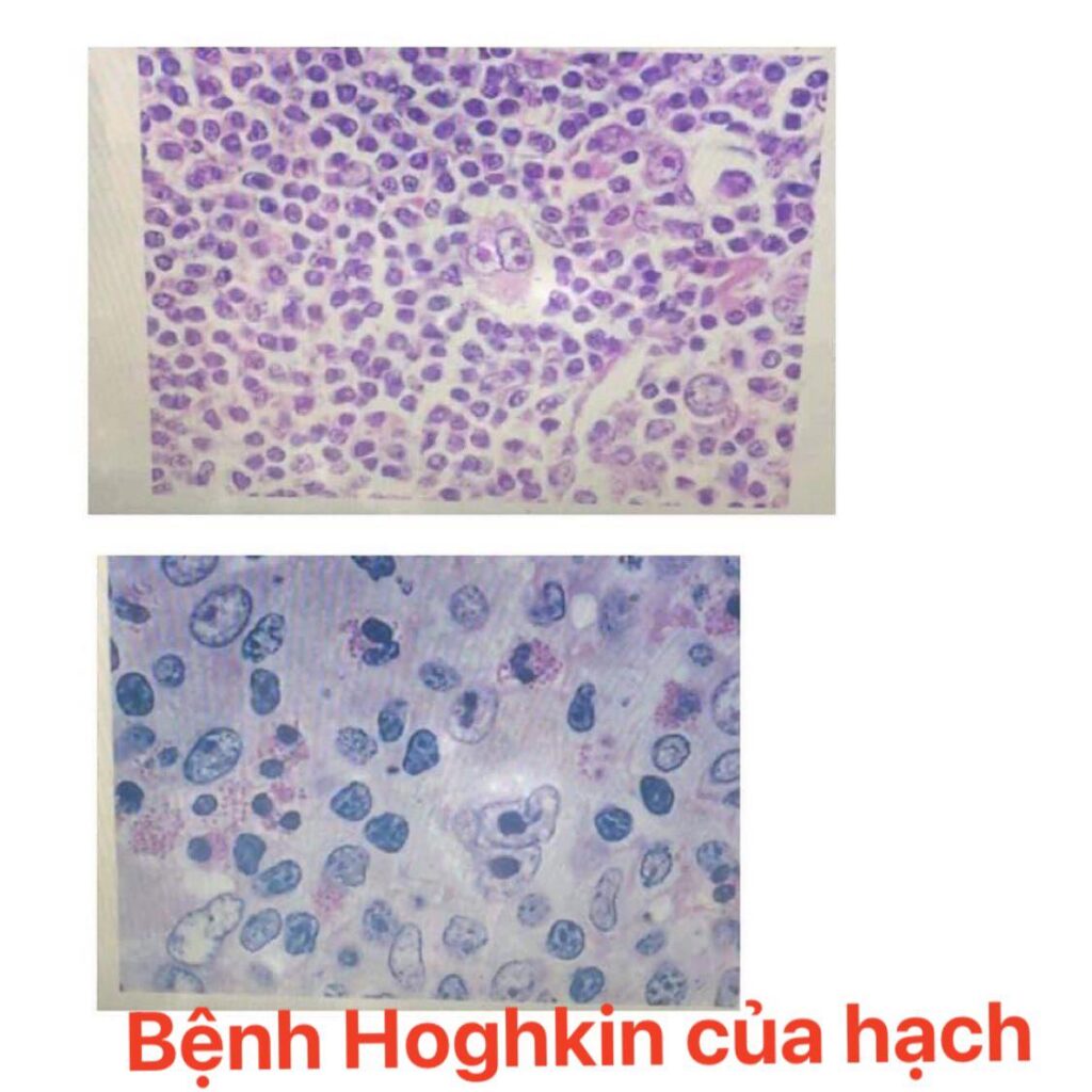 ĐÁP ÁN THI TH GPB SLIDE – Y khoa Tây Nguyên